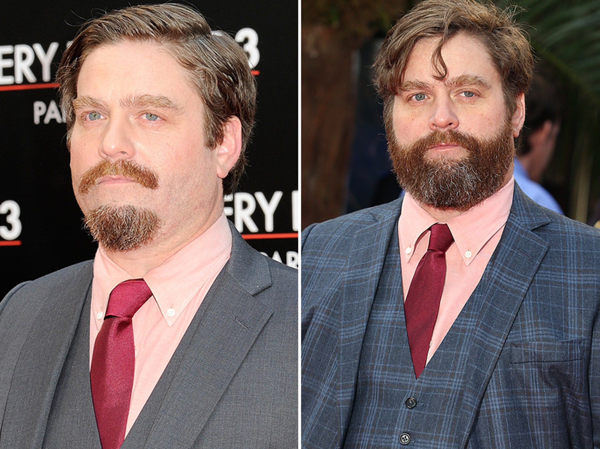 Young Zach Galifianakis Without Beard