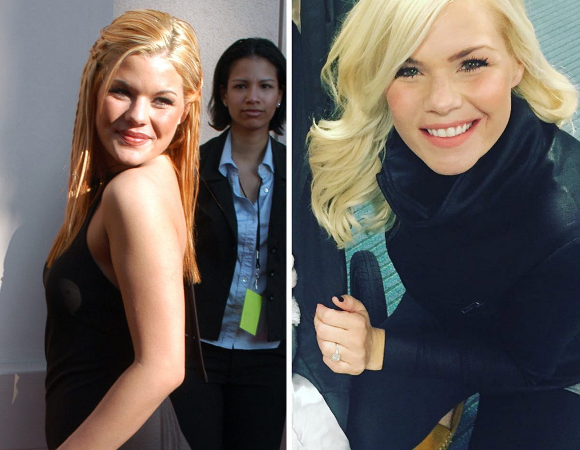 Emily Maynard Plastic Surgery