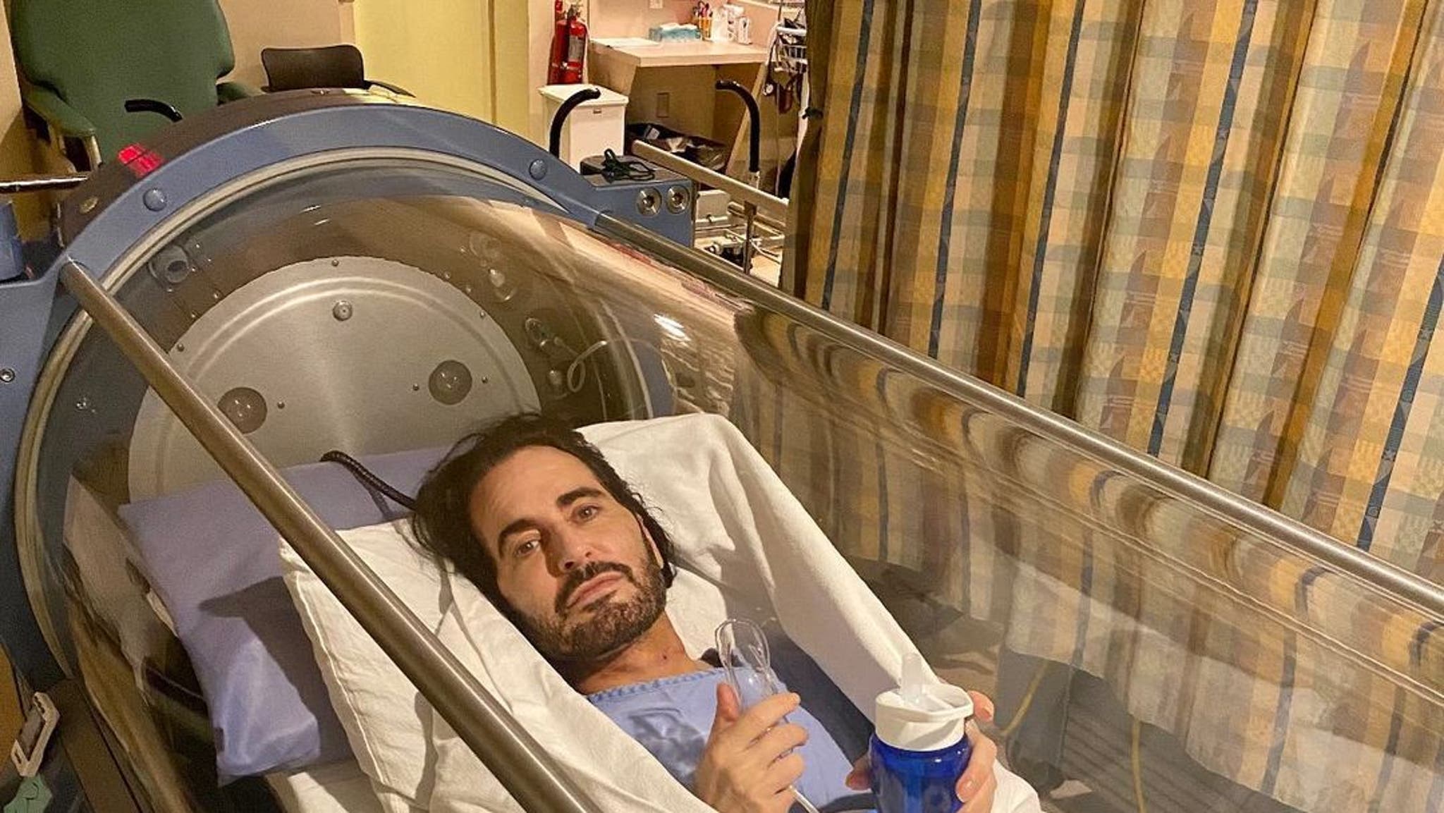 Marc Jacobs Shows Off Facelift Transformation 10 Days After Surgery ...