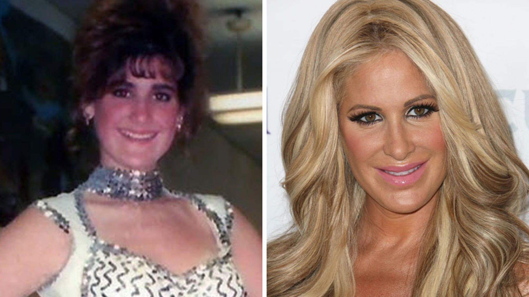 'Real Housewives' Cosmetic Surgery Confessions